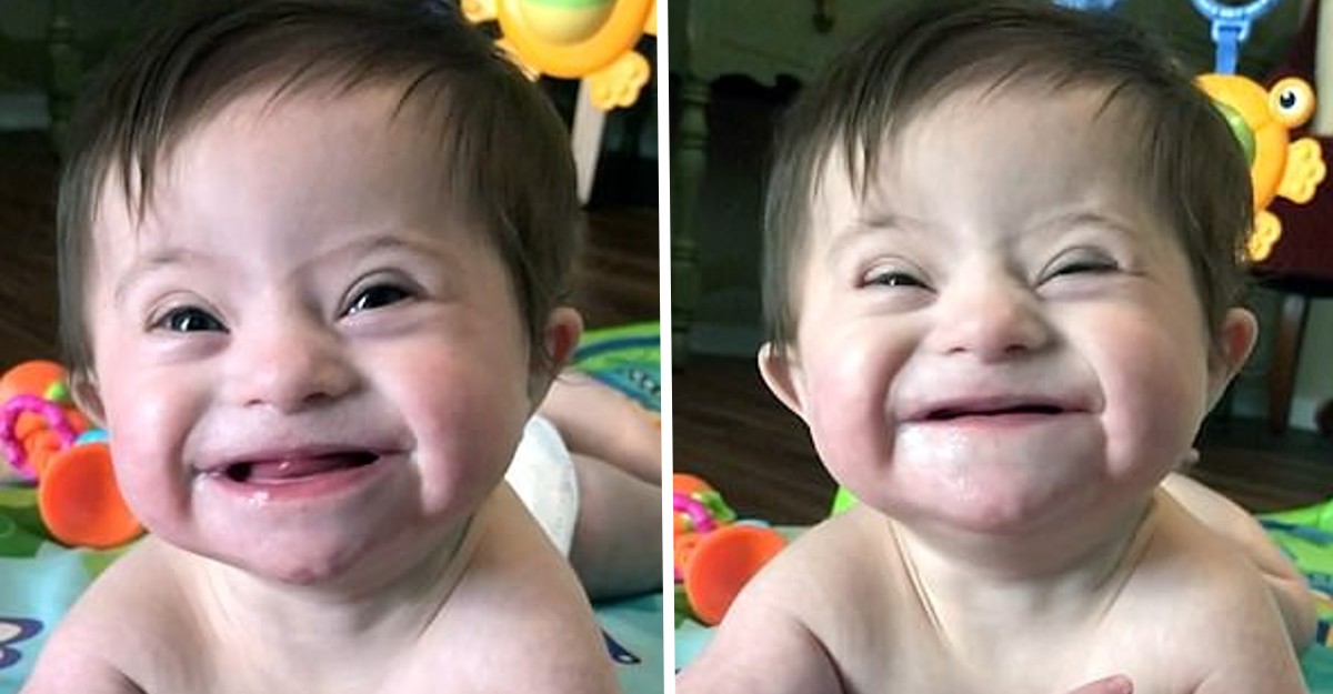 Bebê de 8 meses com síndrome de Down deu à mãe adotiva seu ‘novo ...